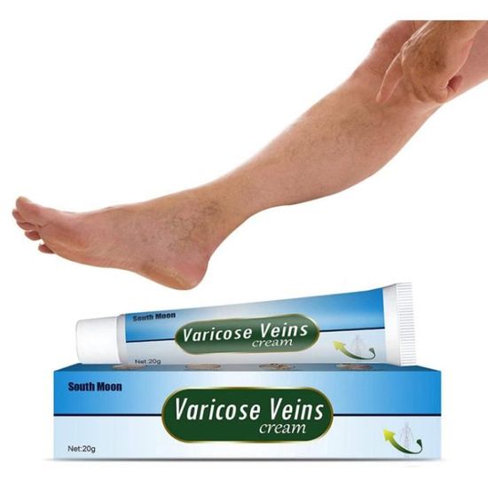 Crème de traitement des varices - Traite efficacement les varices des ...