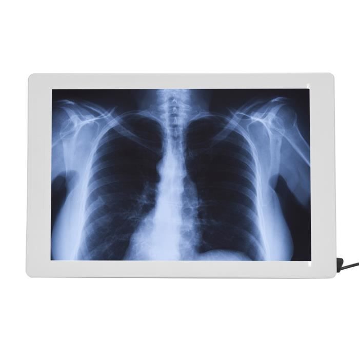 Visionneuse de rayons X LED X- Viewer Prise EU 100-240 V 20 W 36 X 24 ...