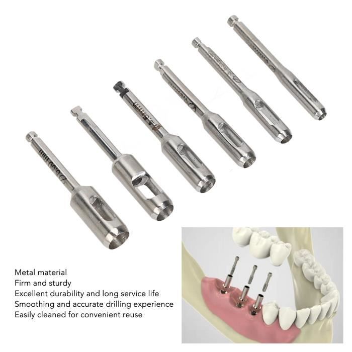 ST5670 Ensemble de fraises trépan pour implant dentaire Kit de forets à ...