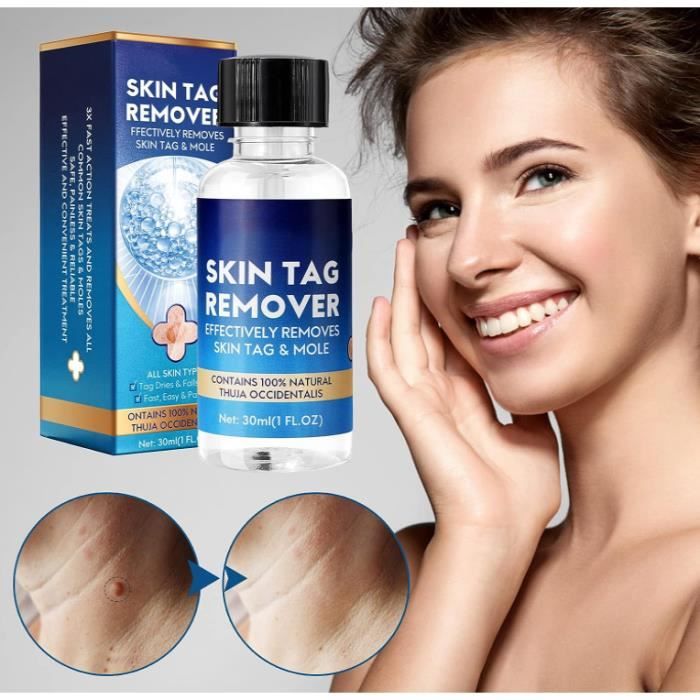 Azote Liquide Anti-verrues-Acrochordons Verrue Traitement Efficace ...