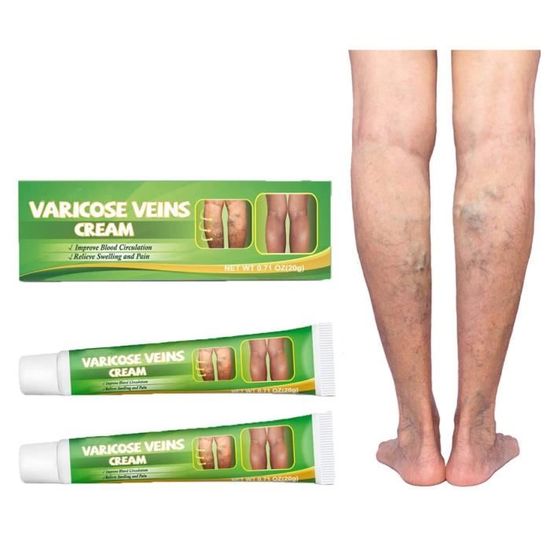 Crème apaisante anti-varices - VeinSmoothing - 2pcs - Améliore la ...