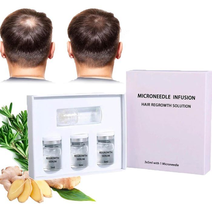 Système de repousse des cheveux, Alpha Infuse, solution de repousse des ...