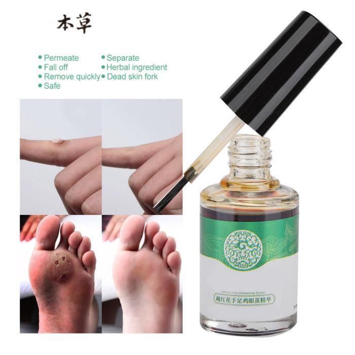 ZJCHAO Dissolvant de verrue Traitement anti-verrue à action rapide sans ...