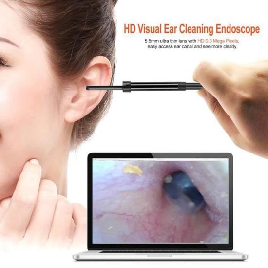 USB Visual Earpick Endoscope HD Visuel Oreille De Nettoyage Cuillère ...