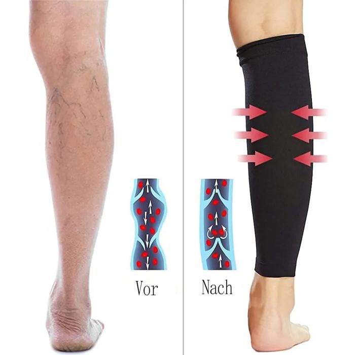 Bas de contention, classe 2 (20-30 mmHg), pour hommes et femmes, pour ...