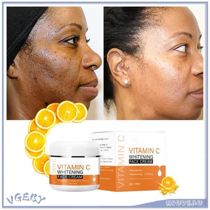 VGEBY Crème pour le visage VC VC Face Cream Hydrating Hydrating Vitamin C Cream Cream for Skin ...