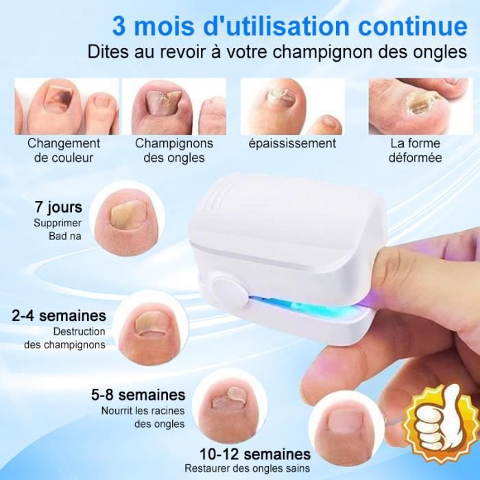 Laser Ongle Mycose Avis