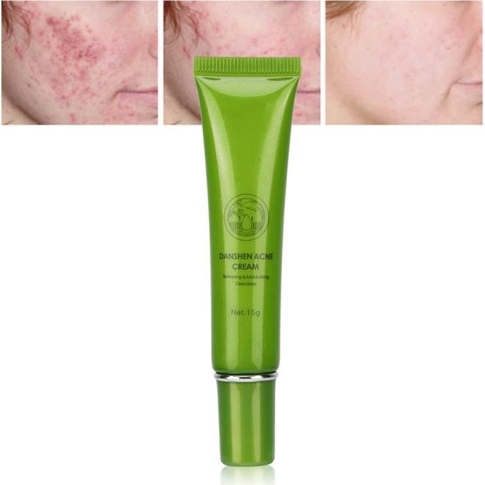 Lotion Pour L'Élimination Des Boutons Mabrem Crème Anti-Acné Points ...