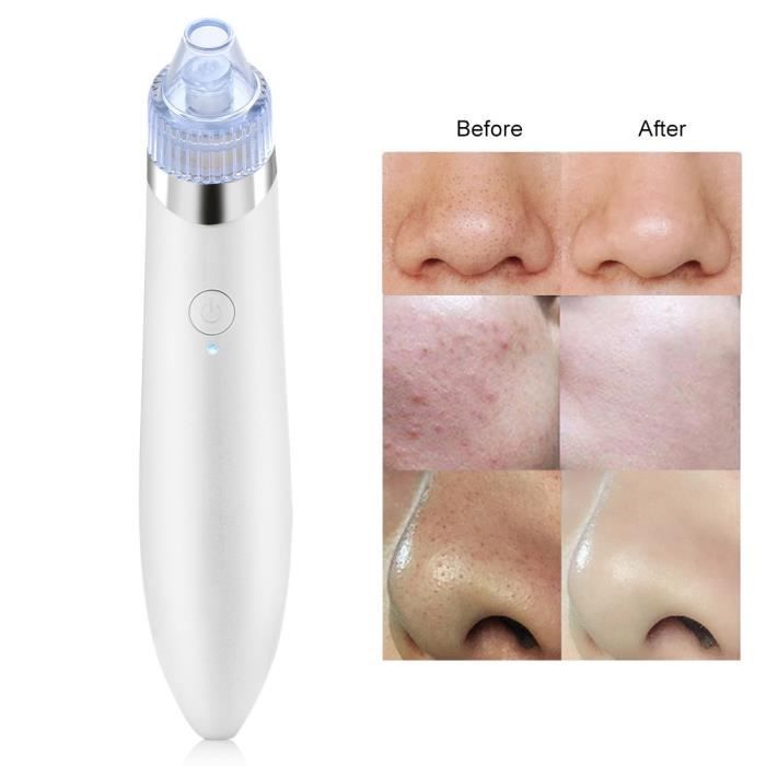 USB Machine électrique de nettoyant d'aspiration de pores de visage ...