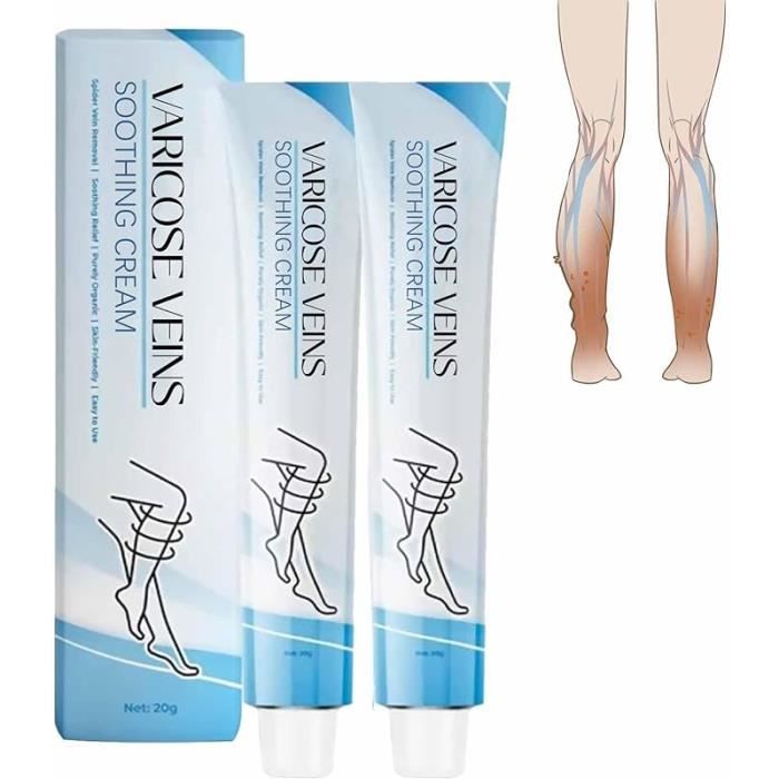 Crme contre les varices traitement des varices sur les jambes crme ...