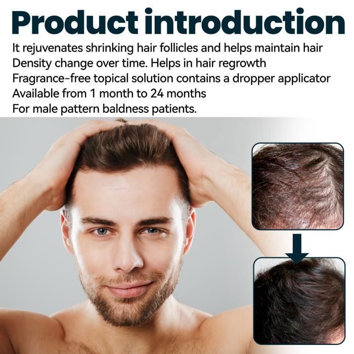 Hair Regen Advanced Hair Regrowth Treatment for Men , Hair Loss ...
