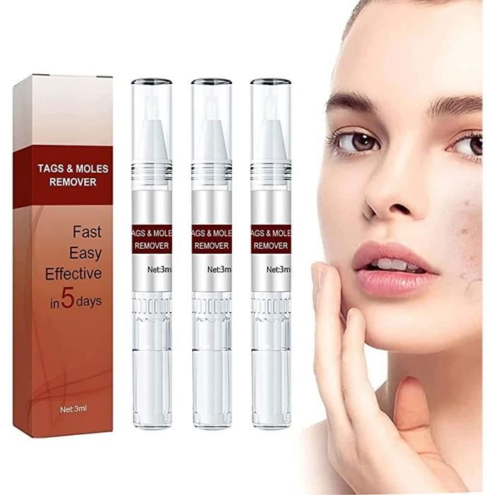 Wipeoff Tags Moles Remover, Wipe Off Tags and Mole Remover, Extreme ...