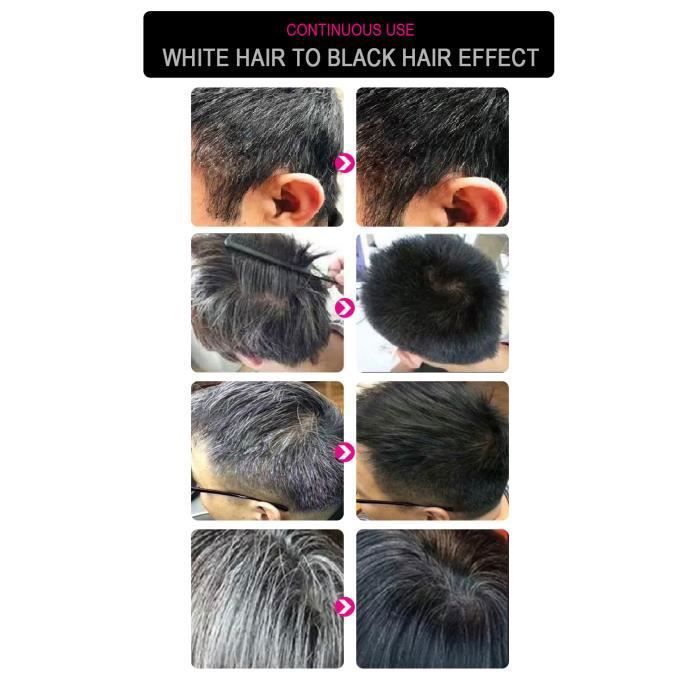 Sérum En Spray Pour Cheveux Gris À Base De Plantes Traitement Pour La ...