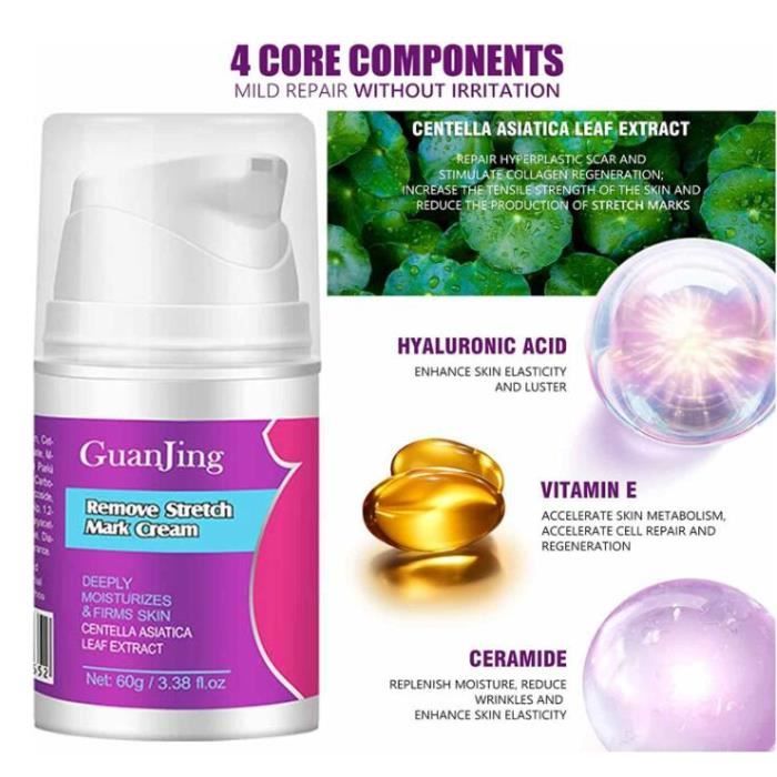 Crème Vergetures Grossesse,Crème anti-cicatrices pour les vieilles ...