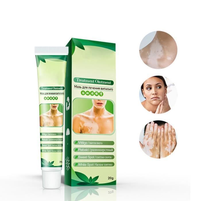 YID Vitiligo Ointment 20g White Spot Disease Onguent Leukoplakia ...