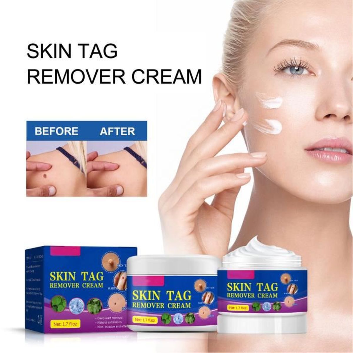 DUO Crème anti-verrues plantaires 150g Crème anti-verrues Crème anti ...