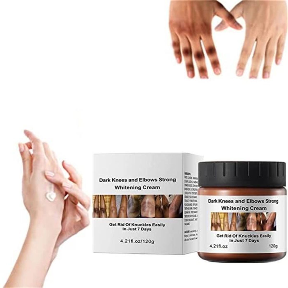 Acanthoglow Therapy Cream,Acanthosis Nigricans Treatment Cream,Dark ...