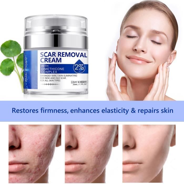 Crème d'élimination des vergetures Crème d'élimination des cicatrices ...