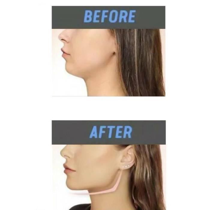 Cou Définir Votre Mâchoire Efficace Mâchoire Exerciseur avec Corde ...