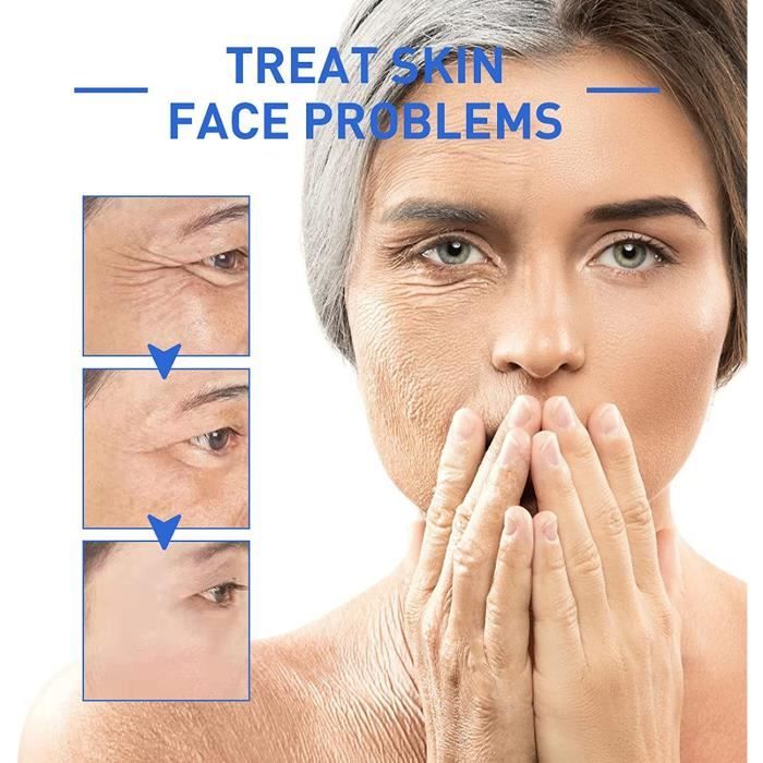 Botox Stock Solution,2023 New Botox Face Serum,Botox Anti Aging Serum ...