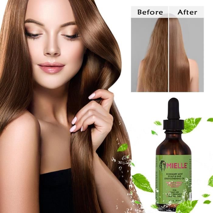 3PCS Rosemary Oil, Huile de Romarin pour Cheveux,Rosemary Oil for Hair Growth et Maintient les ...