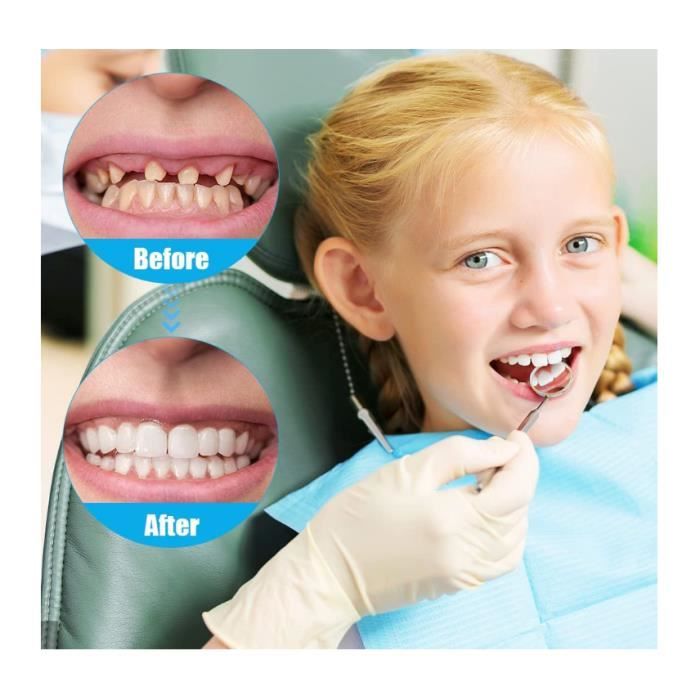 2 Paires Faux Dentier Sourire Parfait, Dent Provisoire Fausse Dent ...