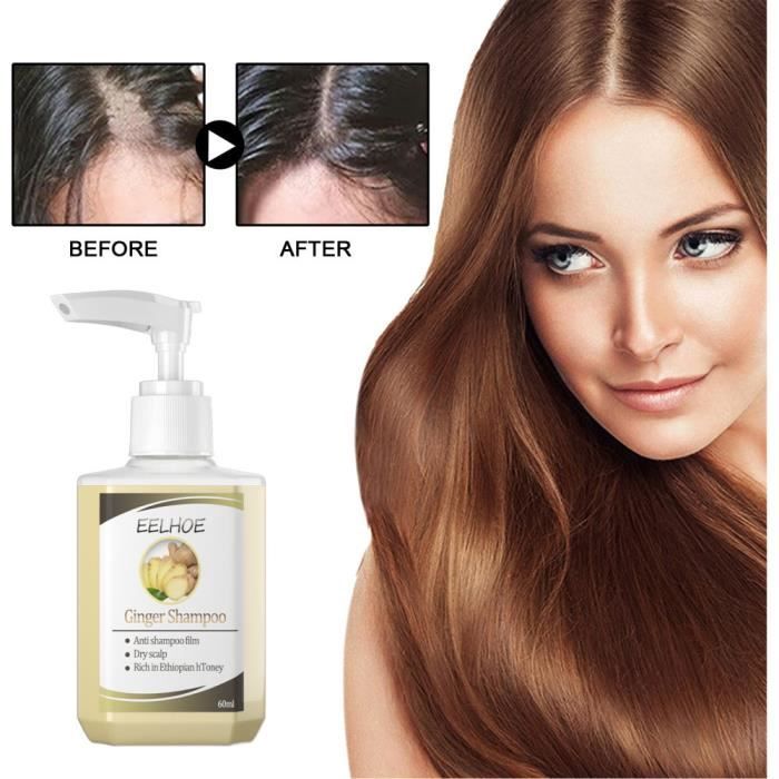 Ginger Anti-Hair Loss Shampoo Oil Control Doux Hydratant Hair Root Hair ...