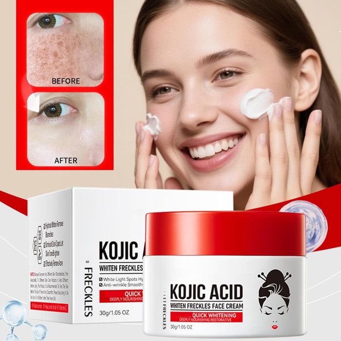 Kojic Acid Creme Anti Tache Visage, Kojic Acid Creme Eclaircissante ...