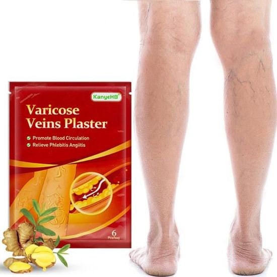 HBjingmaitie-Patch de soins du corps pour varices, plâtre médical à ...