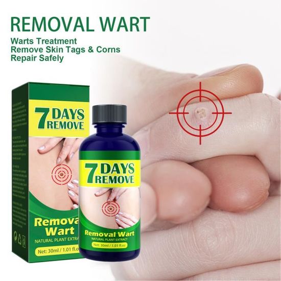 BEA 2pcs 30ml anti-verrues pour verrues cutanées et boutons plats HB058 ...