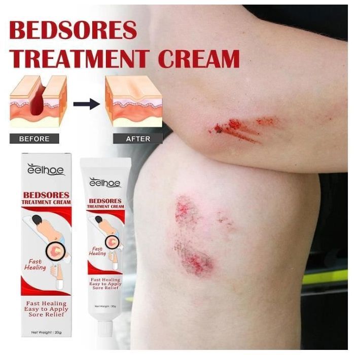 Crème de Soin des plaies Crème cicatrisante Anti-escarres pour Les ...