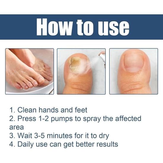 3 Pcs Furzero Spray pour Le Traitement des Pieds des Athlètes, Furzero ...