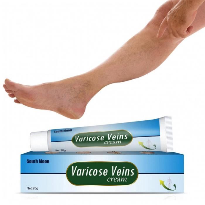 Crème De Traitement Des Varices - Traitement Efficace Des Varices Pour ...