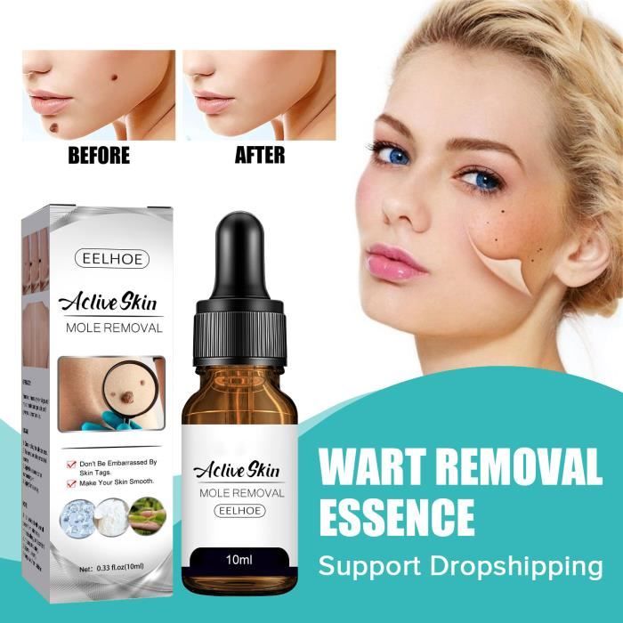 Essence dissolvant de verrues,contre les grains de beauté, liquide pour ...