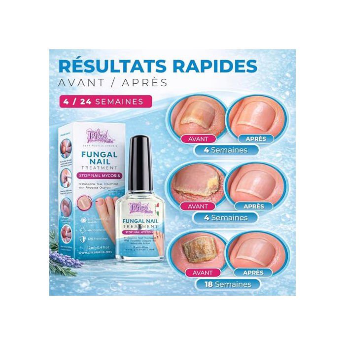 Traitement Mycoses ongles des pieds et mains 12 ml - Cdiscount Santé ...