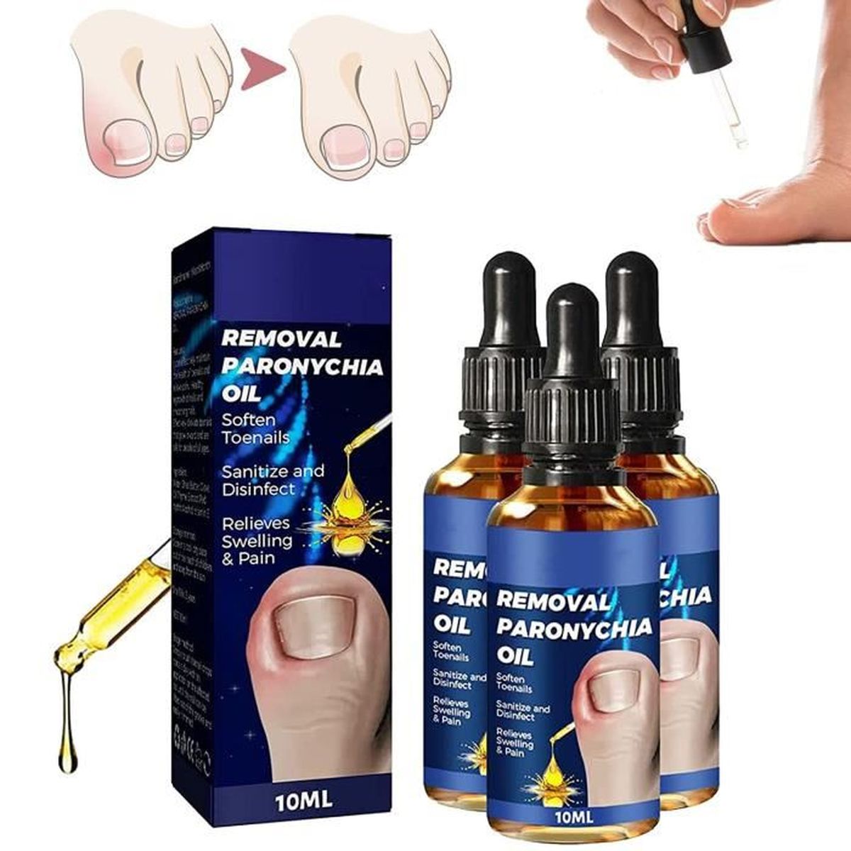 Removal Paronychia Oil, Toenail Anti Paronychia Relief Oil, Toe and ...
