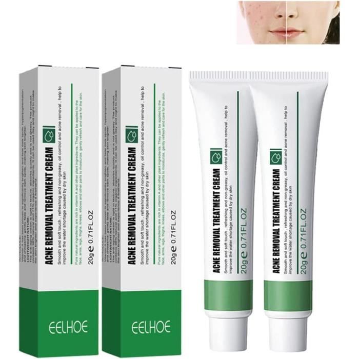 2 Pcs Whitening Freckle Cream, Remove Melasma Cream, Acne Scar Removal ...