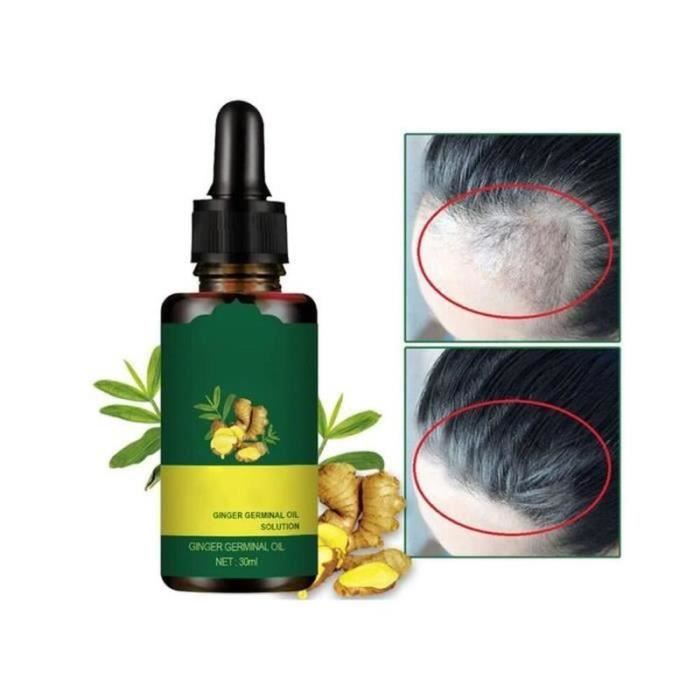 TRAITEMENT CAPILLAIRE - TRAITEMENT ANTI-CHUTE Sérum de Croissance de ...