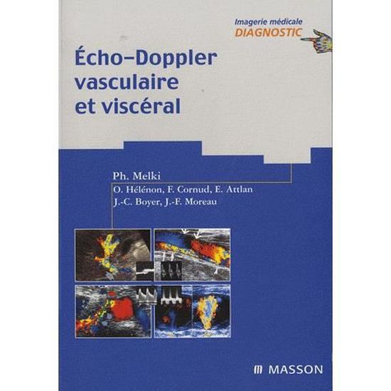 Echo-Doppler vasculaire et viscéral - Cdiscount Librairie