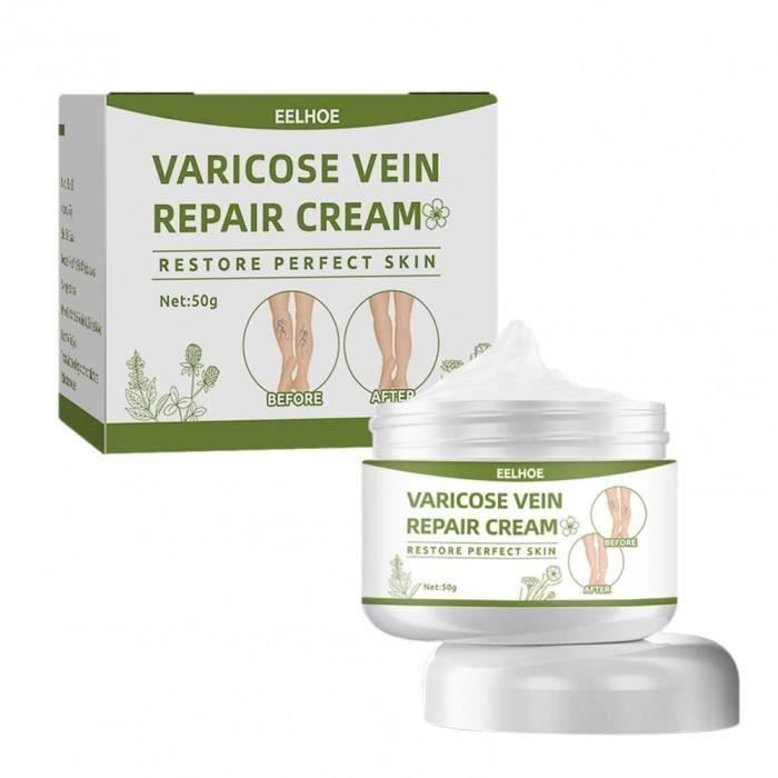 Crème anti-varices - Crème naturelle contre les varices - Traitement ...