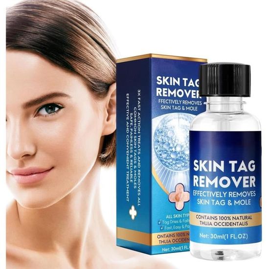 2pc Azote Liquide Anti-verrues,Acrochordons Traitement Efficace,Sérums ...