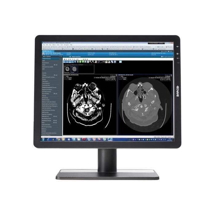 BARCO Eonis MDRC-2221 Écran LED - 2MP - Couleur - 21" - 1600 x 1200 ...