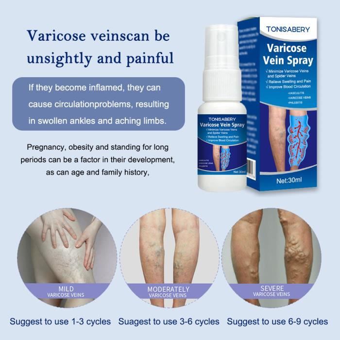 TONISABERY VaricesSpray Varices,Varices Crème, Varices Traitement ...