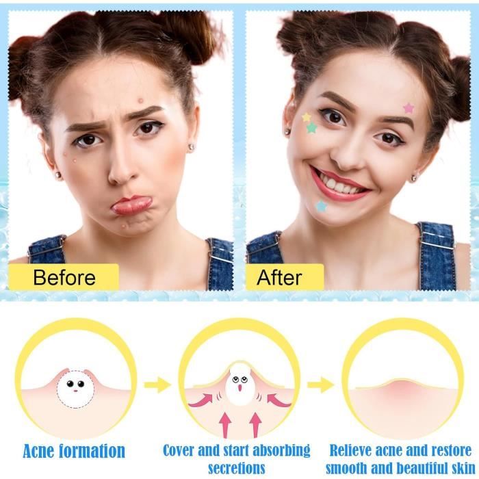 Patchs Anti-Imperfections Hydrocolloïdes - MARQUE - 160 Patches ...