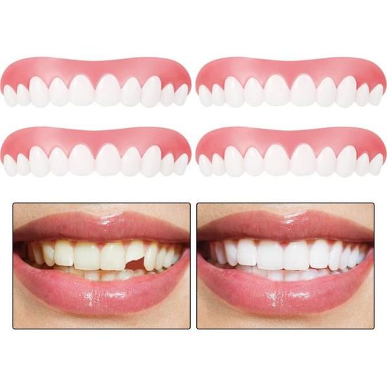 Kits dentaires Facettes Dentiers Instantanées Dentier Dents Couvrant ...