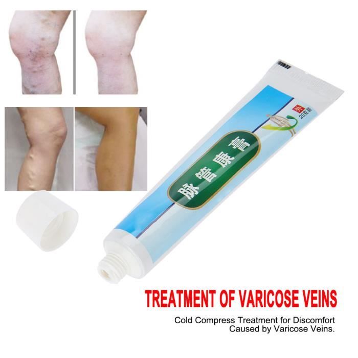 Mxzzand Crème contre les varices Phlébite varices effondrement Kang ...