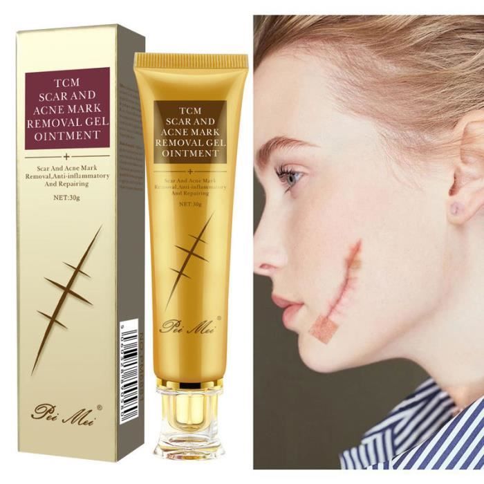 Crème Réparatrice pour Cicatrices d'Acné Gel pour Vergetures ...