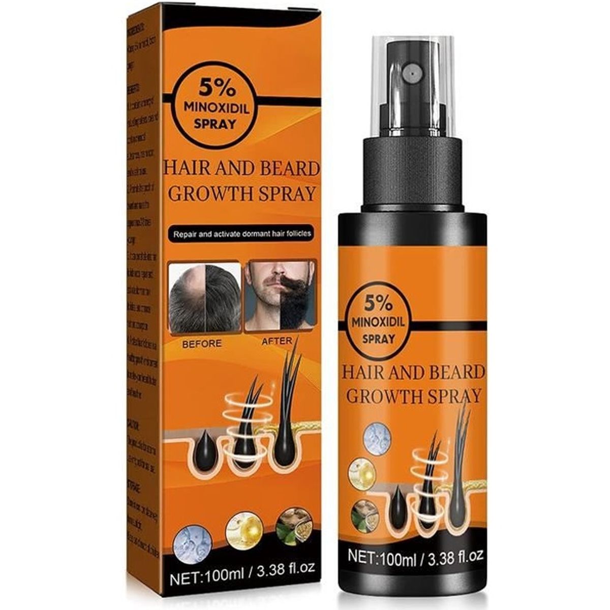 5 Minoxidil For Men And Women Hair Growth Spray For Stronger Thicker