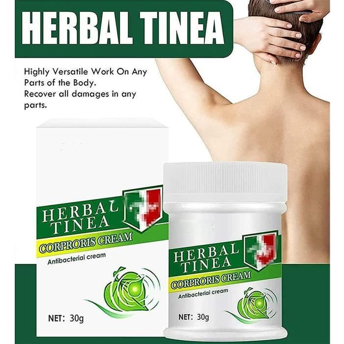 Herbal Tinea Corporis Cream,Tinea Versicolor Treatment,Anti-Pruritus ...
