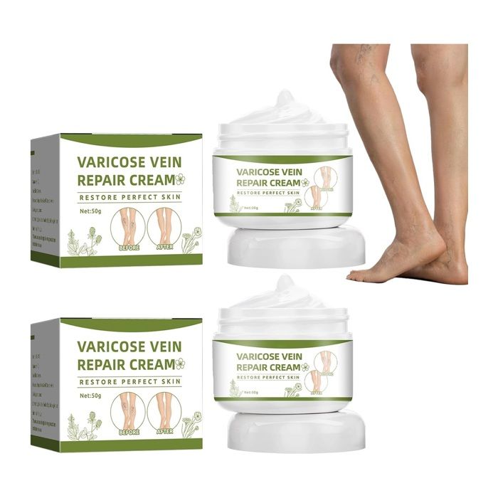 Varicose Veins Cream,Crème pour les Varices Anti Varicose Veins Cream ...